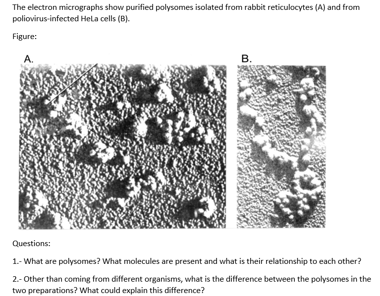 Solved The electron micrographs show purified polysomes | Chegg.com