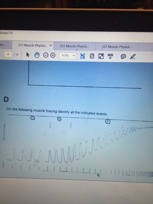 On the following muscle tracing identify all the | Chegg.com
