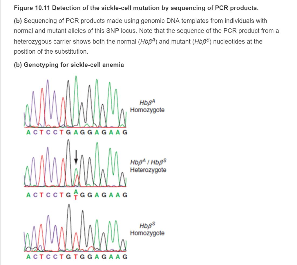 Solved You sequence a PCR product amplified from a person's | Chegg.com