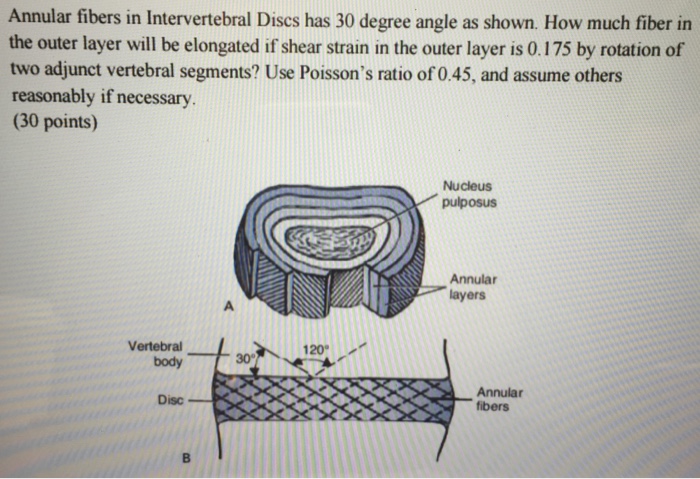 Solved Annular fibers in Intervertebral Discs has 30 degree | Chegg.com