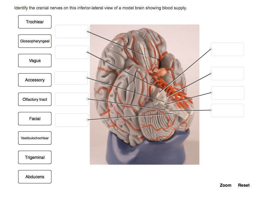 Solved Identify the cranial nerves on this inferior-lateral | Chegg.com