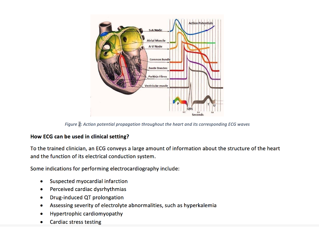 Solved Please Interpret these two ECG graphs and indicate | Chegg.com