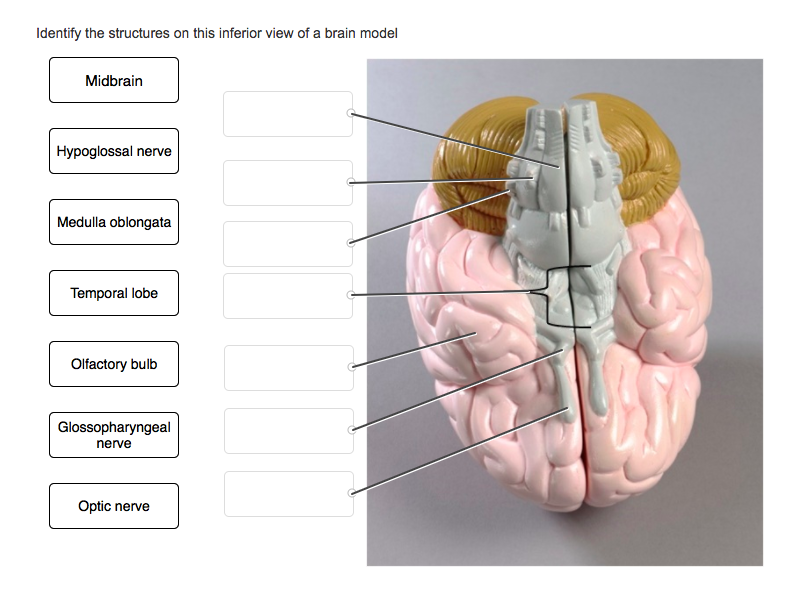 Solved Identify the structures on this inferior view of a | Chegg.com