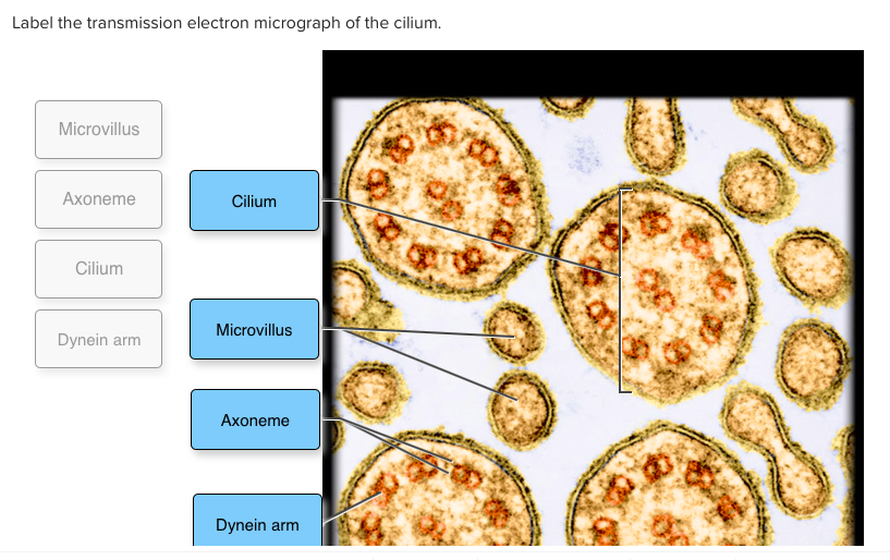 Solved Label the transmission electron micrograph of the | Chegg.com