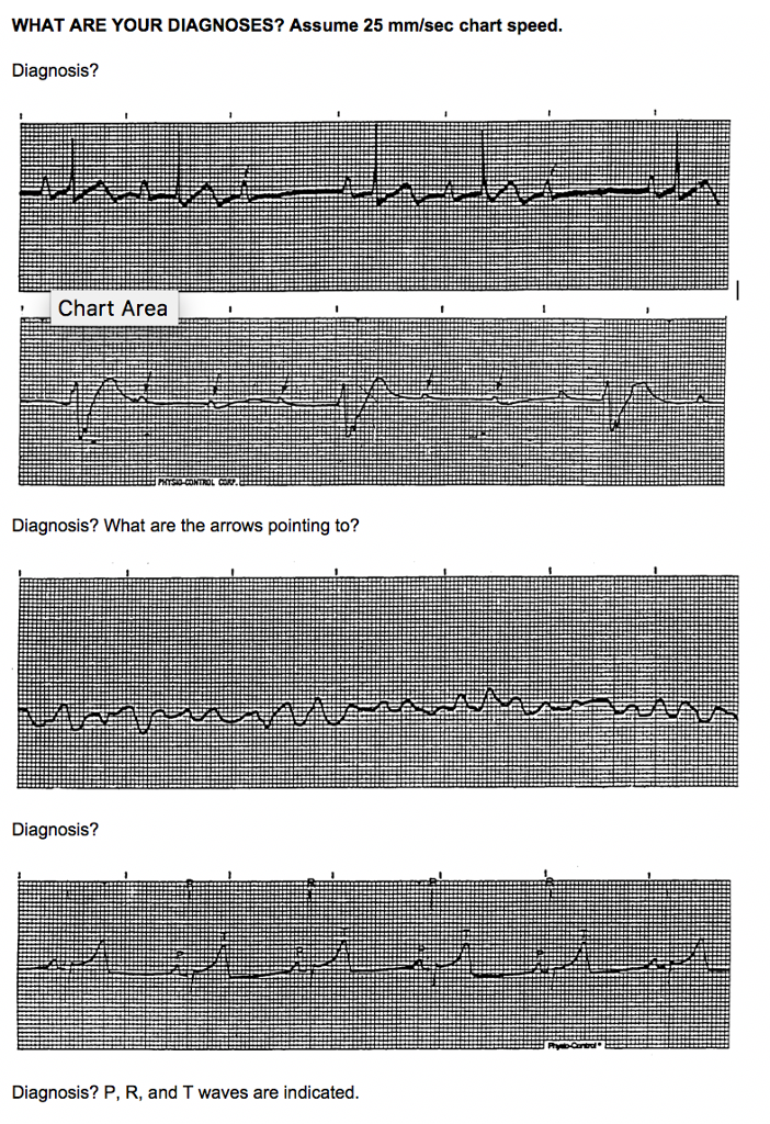 WHAT ARE YOUR DIAGNOSES? Assume 25 mm/sec chart speed | Chegg.com