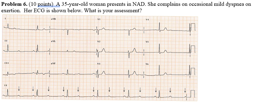 Solved vs v2 | Chegg.com