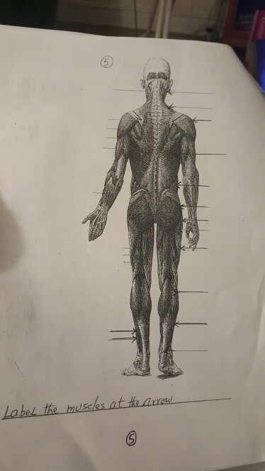 Solved LabeL the muscles at the arrow | Chegg.com