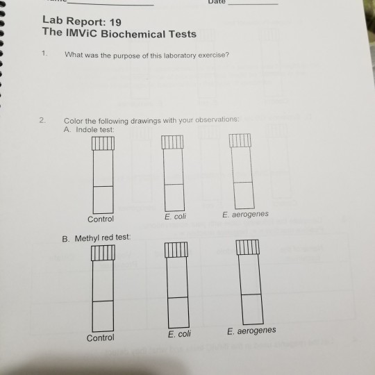Solved Lab Report: 19 The IMViC Biochemical Tests 1. What | Chegg.com