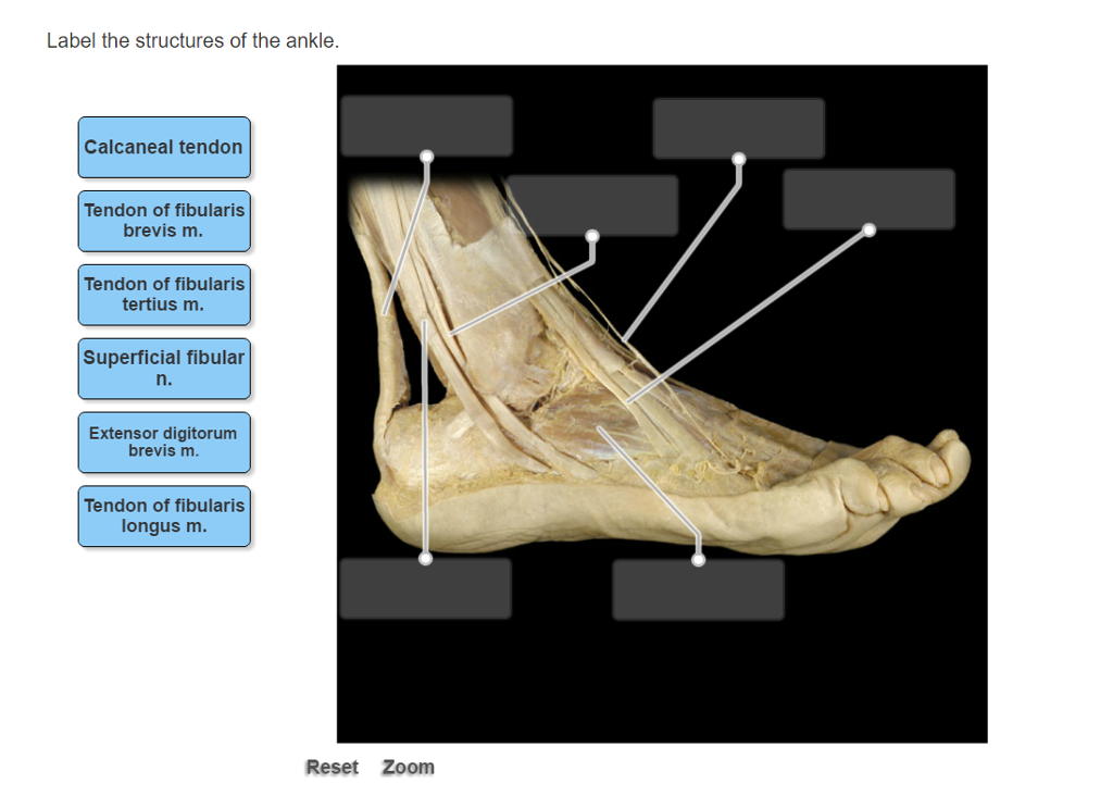 Solved Label the structures of the ankle. | Chegg.com