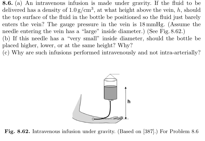 Solved An intravenous infusion is made under gravity. If the | Chegg.com