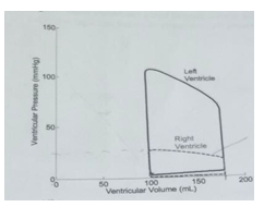 Solved The graph depicts the pressure volume loop of the | Chegg.com