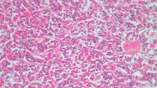 Solved Choose which microscope slide out of the three below | Chegg.com