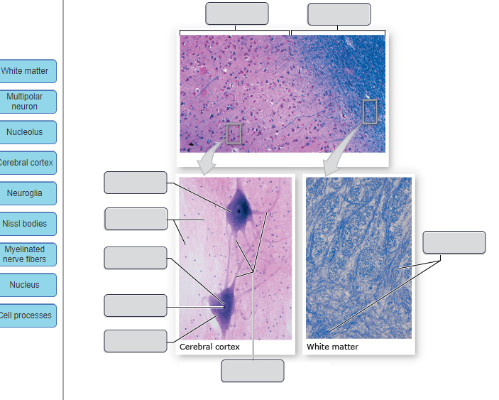 Solved White matter Multipolar neuron Nucleolus erebral | Chegg.com