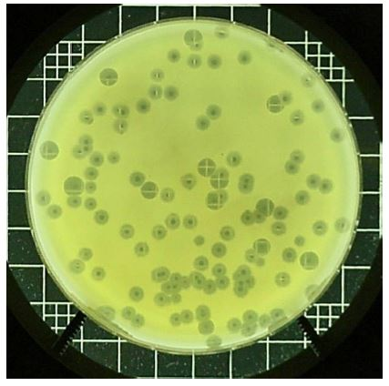 Solved Observe this soft agar overlay plate of Escherichia | Chegg.com