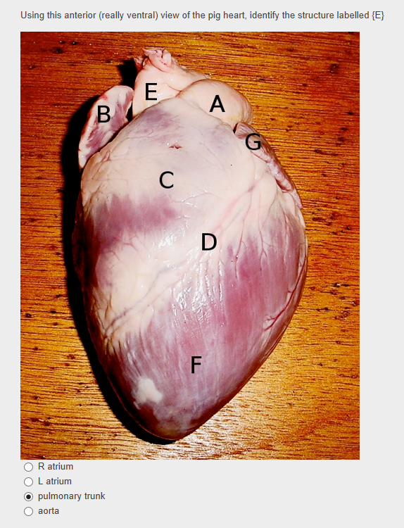 Solved Using this anterior (really ventral) view of the pig | Chegg.com