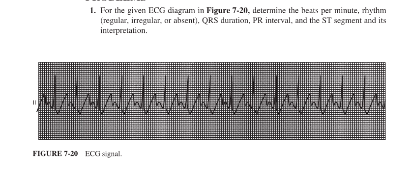 Solved For the given ECG diagram in Figure 7-20, determine | Chegg.com