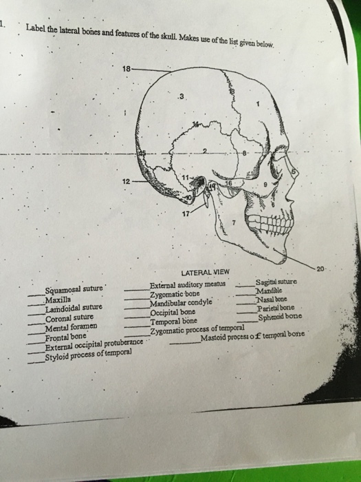 Solved Label the lateral bones and features of the skull. | Chegg.com