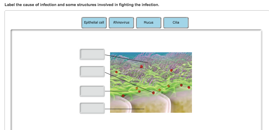Solved Label the cause of infection and some structures | Chegg.com Solved Label the cause of infection and some structures | Chegg.com