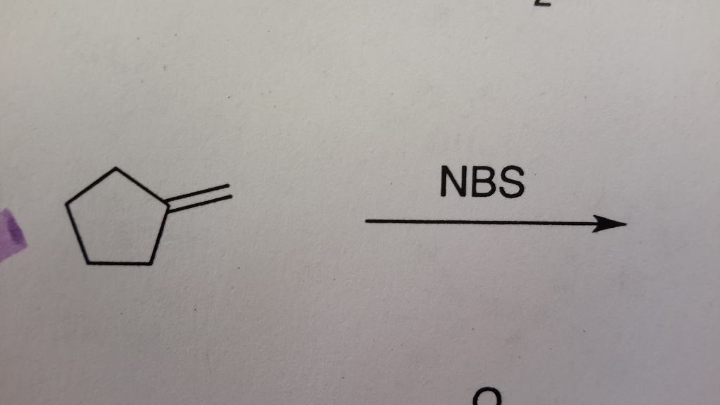 Solved NBS | Chegg.com