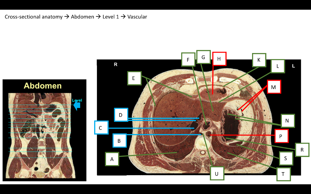 Solved Cross-sectional anatomy → Head & Neck-) Level 4 Head | Chegg.com