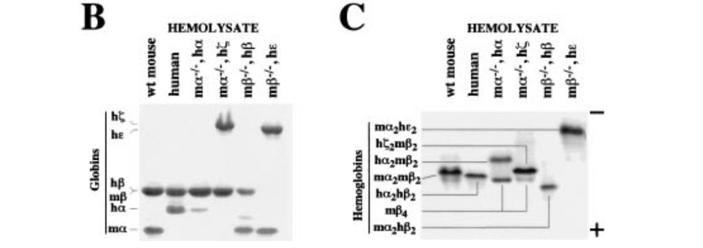 Solved could someone help explain this triton-acid-urea gel | Chegg.com