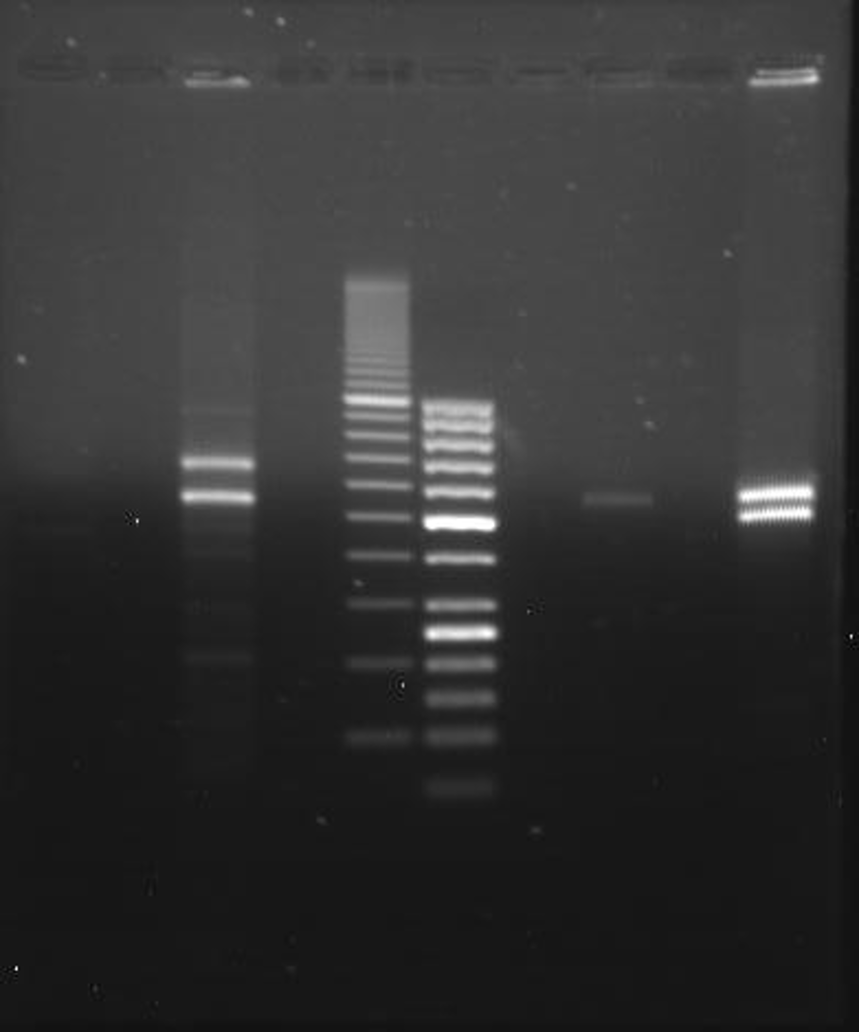 Observe the photograph of the stained gel containing | Chegg.com