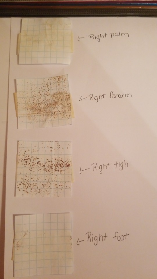 Solved Need help. Graph paper is 5.0 cm each. Count the | Chegg.com Solved Need help. Graph paper is 5.0 cm each. Count the | Chegg.com