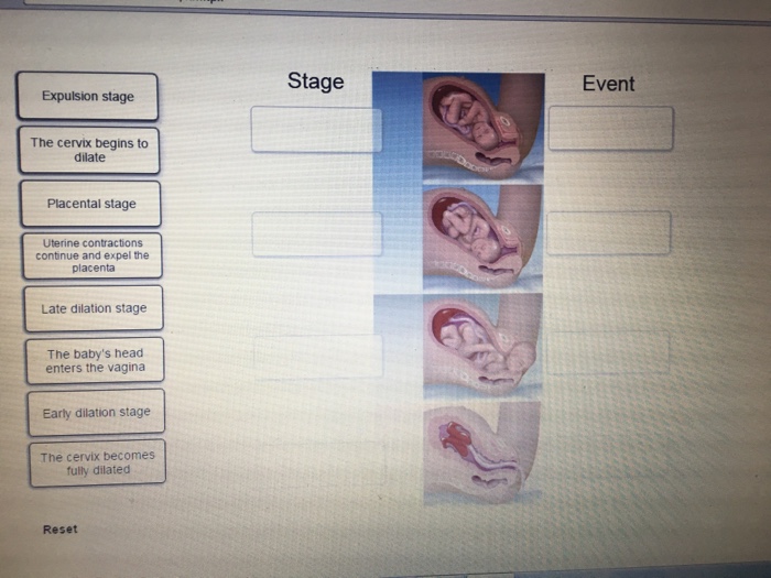 Solved Expulsion stage The cervix begins to dilate Placental | Chegg.com