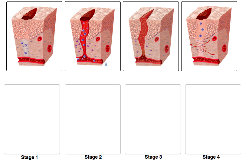 Solved Click and drag the images below into the proper | Chegg.com