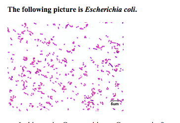 Solved LAB MODULE: STAINING– STUDY HELP Instructions: | Chegg.com