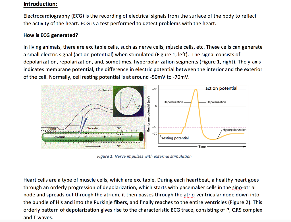 Solved Please Interpret these two ECG graphs and indicate | Chegg.com