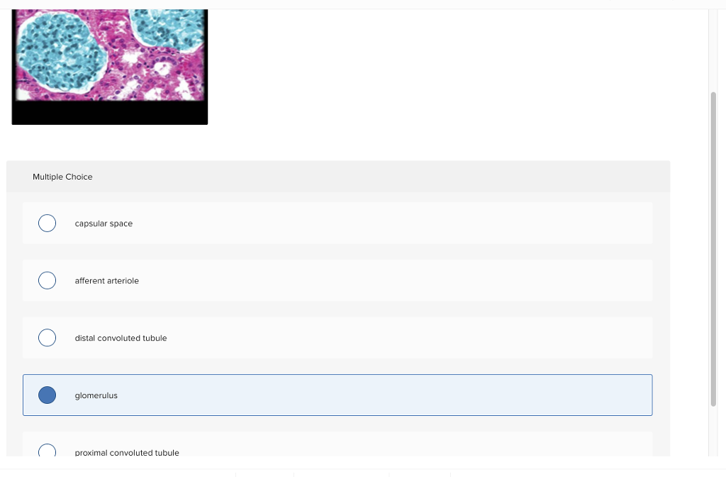 Solved Multiple Choice capsular space afferent arteriole | Chegg.com