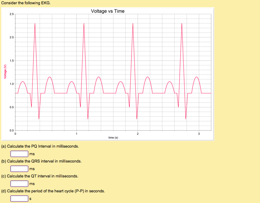 Consider the following EKG. Calculate the PQ | Chegg.com