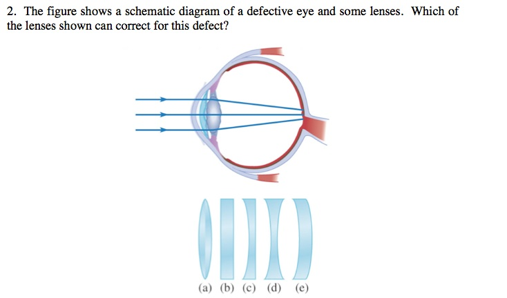Solved The figure shows a schematic diagram of a defective | Chegg.com