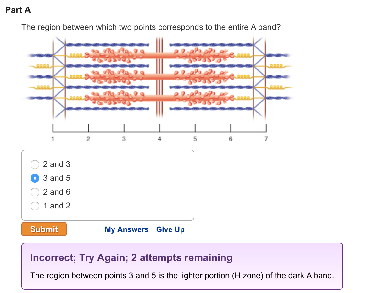 Solved The region between which two points corresponds to | Chegg.com