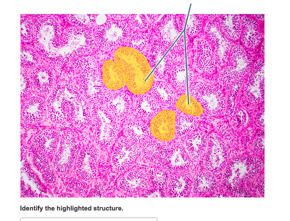 Solved Identify the highlighted structure. | Chegg.com