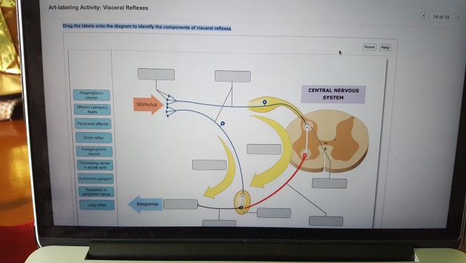 Solved Art-labeling Activity: Visceral Reflexes 14 of 1 Drag | Chegg.com