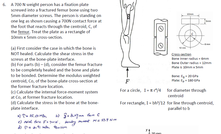 Solved A 700 N weight person has a fixation plate screwed | Chegg.com
