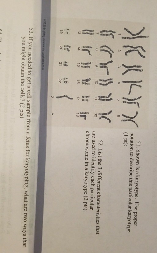 Solved 51. Shown is a karyotype. Use proper notation to | Chegg.com