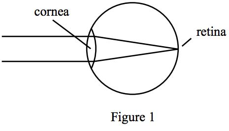 Solved Figure 1 shows a simplified model of the eye that is | Chegg.com