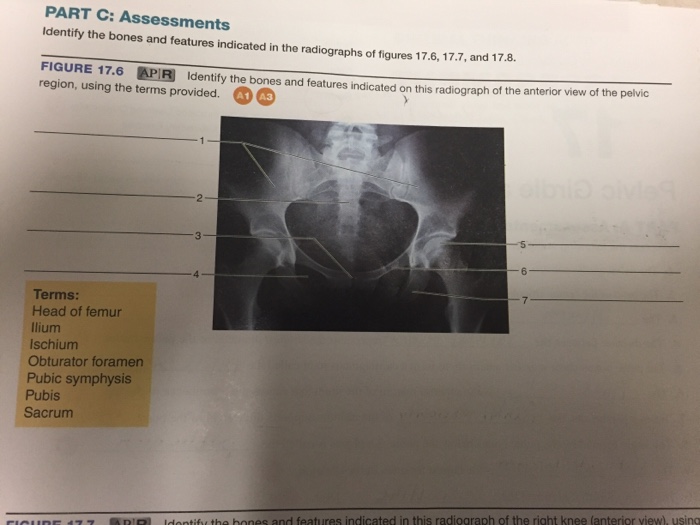 Solved Identify the bones and features indicated on this | Chegg.com
