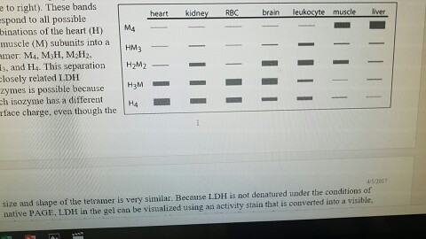 Solved M3H MH3 TITAN GEL LDH 1 bovine LDH isozyme control 2 | Chegg.com