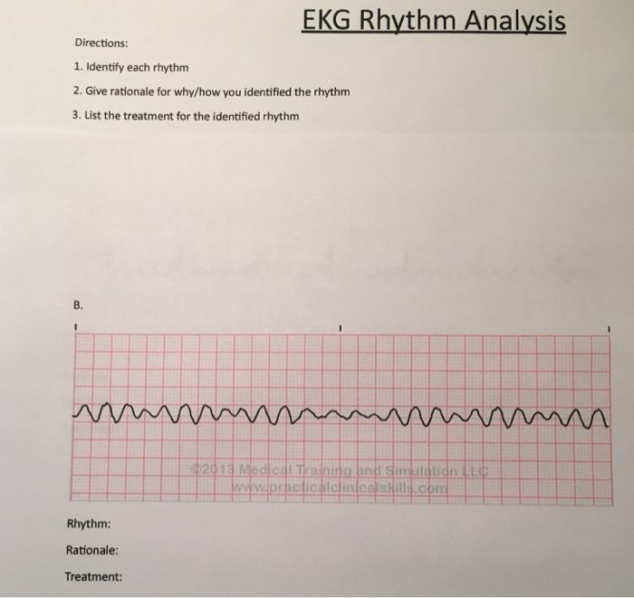 Solved EKG Rhythm Analysis Directions 1. Identify each | Chegg.com