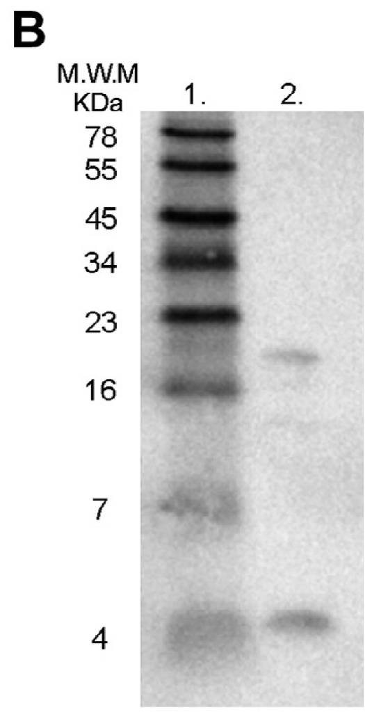 1. The Western blot analysis of an amyloid protein | Chegg.com