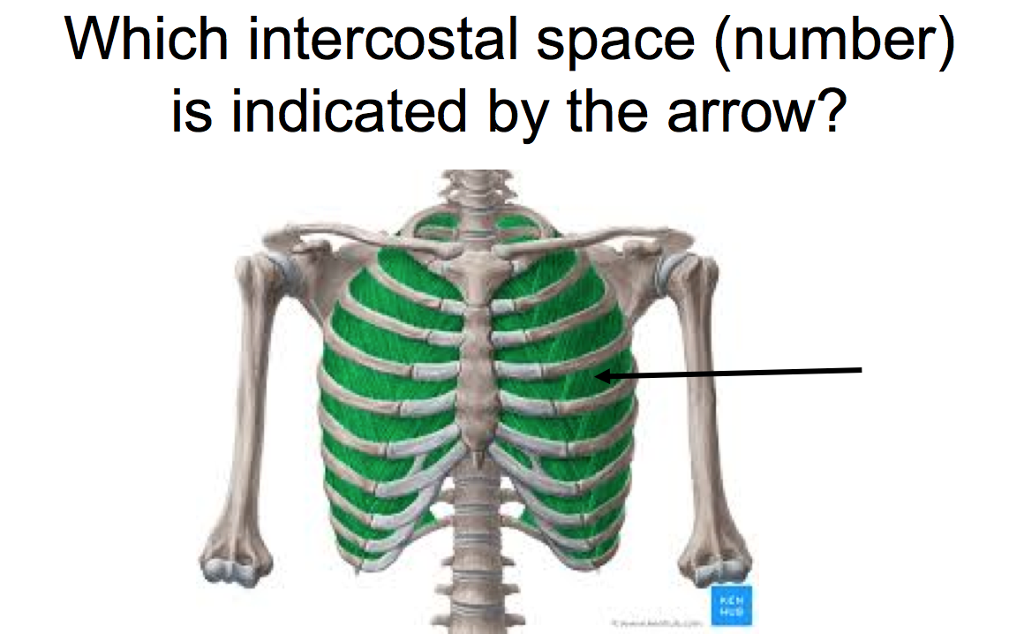 Solved Which Intercostal Space number Is Indicated By The Chegg