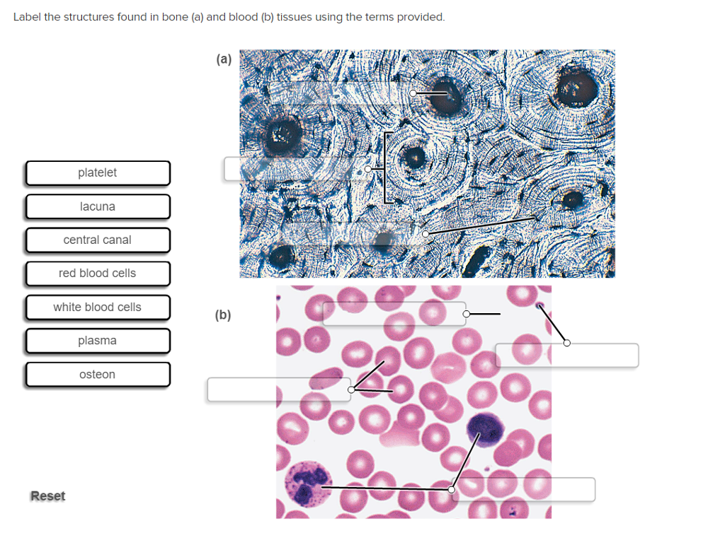 Solved Label the structures found in bone (a) and blood (b) | Chegg.com