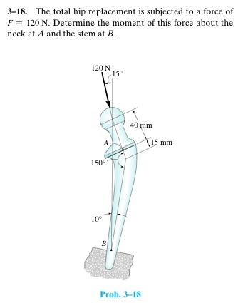 Solved The total hip replacemnt is subjected to a force of | Chegg.com