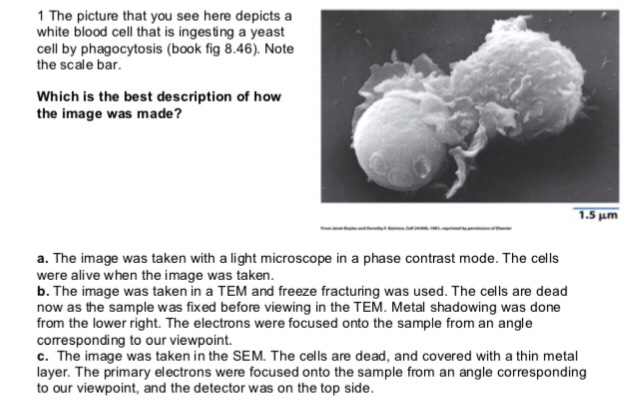 Solved The picture that you see here depicts a white blood | Chegg.com