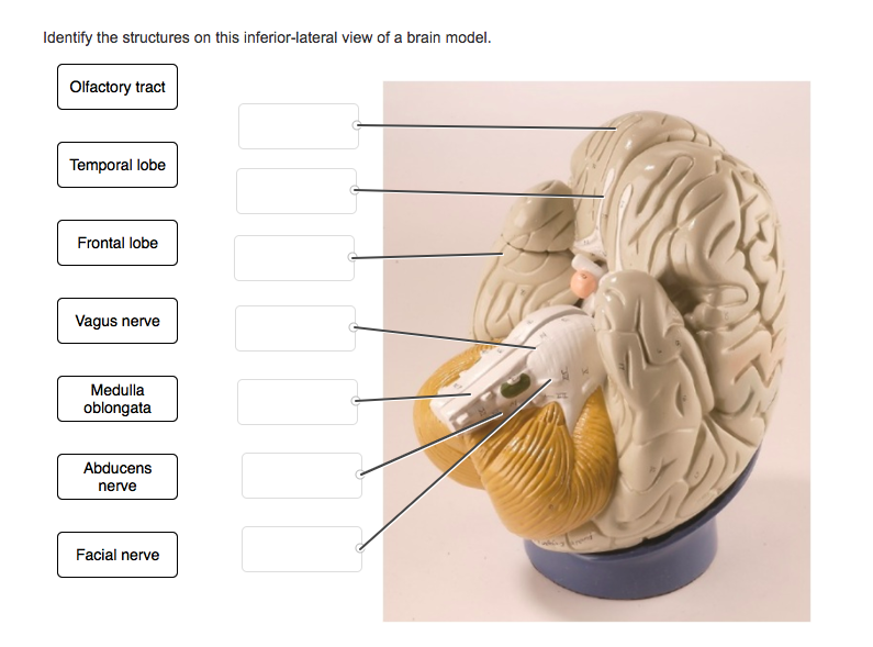 Solved Identify the structures on this inferior-lateral view | Chegg.com