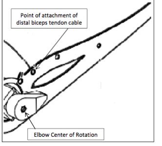 Solved Point of attachment of distal biceps tendon cable | Chegg.com